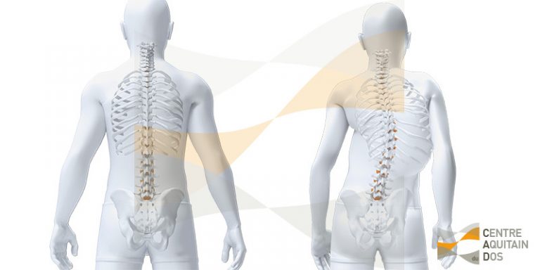 Centre Aquitain du dos : Pathologies